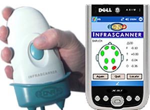 FDA approves intracranial bleeding detector