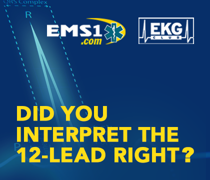How to assess tricyclic antidepressant overdose (TCA) | 12- lead EKG case