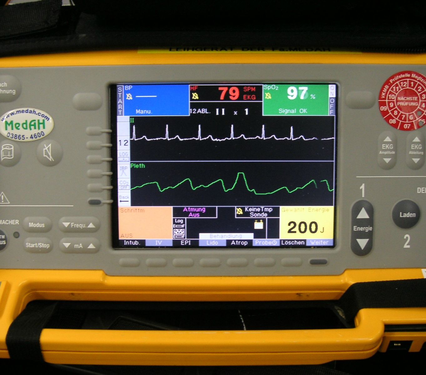From DKA to CPR, sepsis: 5 ways you aren’t using your cardiac monitor