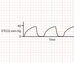 EMS assessment and treatment of asthma: 5 things to know