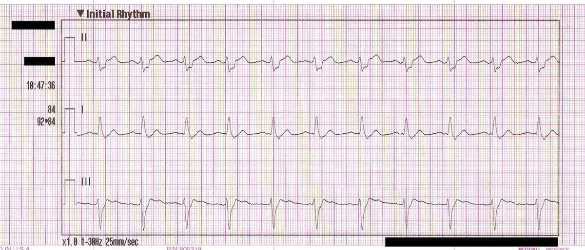 ECG Challenge: Winter, spring or summer