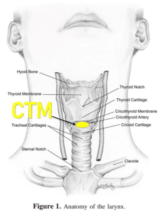 EMS case study: Review surgical airway challenges; best practices