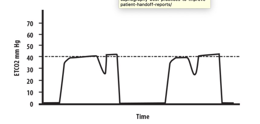 Training day: 3 Waveform capnography scenarios