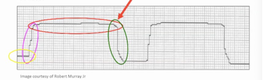 EMS waveform capnography, EtCO2 pitfalls